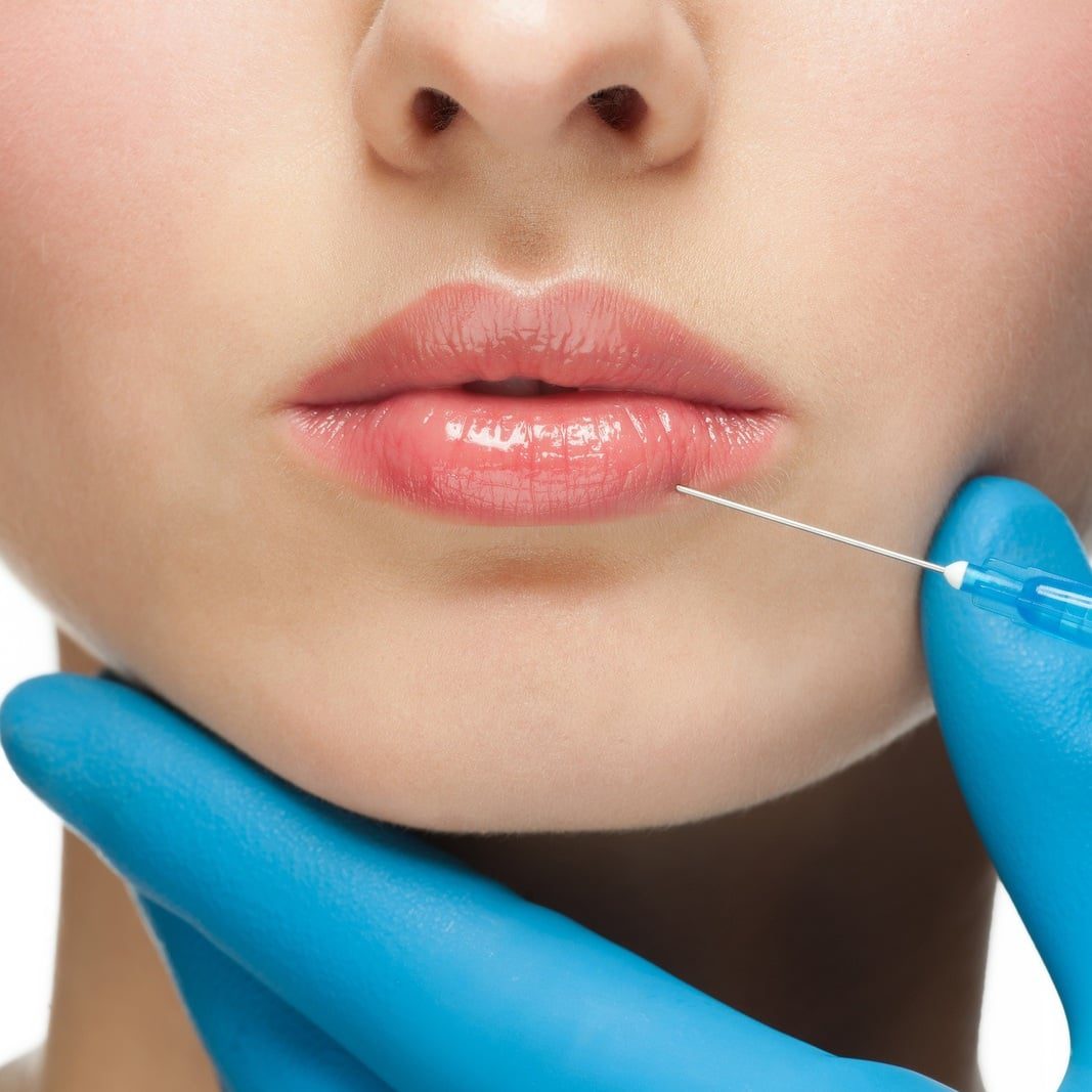 Delinear y aumentar labios | Tratamientos | Estéticos | Faciales ...